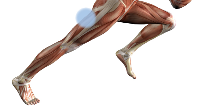 Proximal Hamstring Tendinopathy – Gold Coast Physio & Sports Health ...